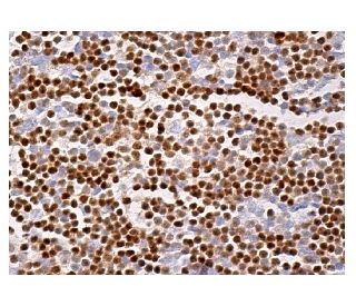 LEF-1 Antibody (B-6) - Immunohistochemistry - Image 159092