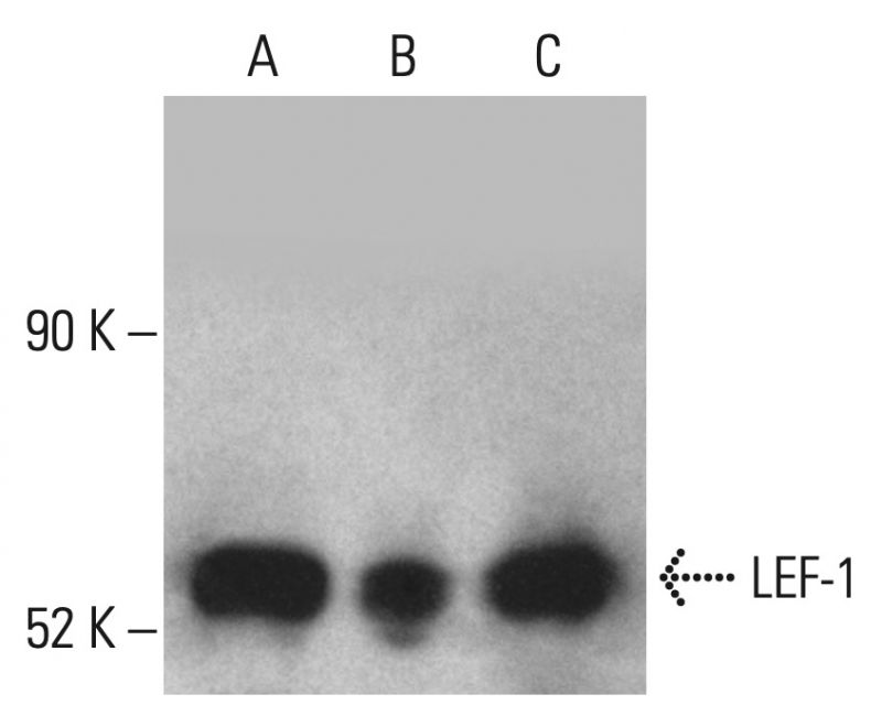 LEF-1抗体 (B-6) | SCBT - Santa Cruz Biotechnology