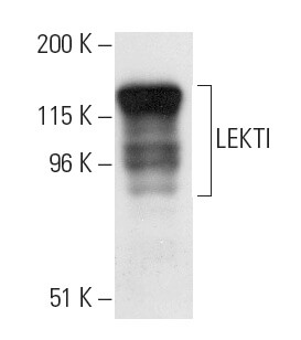 Anti-LEKTI Antibody (1C11G6) | SCBT - Santa Cruz Biotechnology