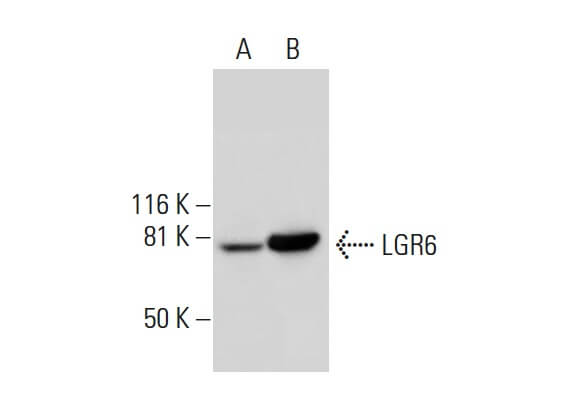 LGR6 Antibody (F-5) | SCBT - Santa Cruz Biotechnology