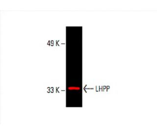 LHPP Antibody (B-2) - Western Blotting - Image 394721