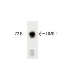 LIMK-1抗体 (42) | SCBT - Santa Cruz Biotechnology