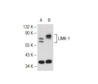 LIMK-1 Antibody (C-10) | SCBT - Santa Cruz Biotechnology