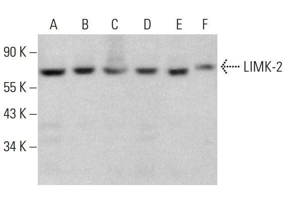 LIMK-2 Antibody (A-12) | SCBT - Santa Cruz Biotechnology