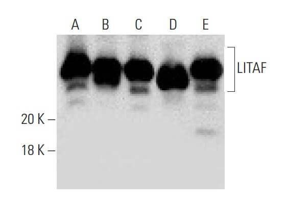 LITAF Antibody (C-5) | SCBT - Santa Cruz Biotechnology