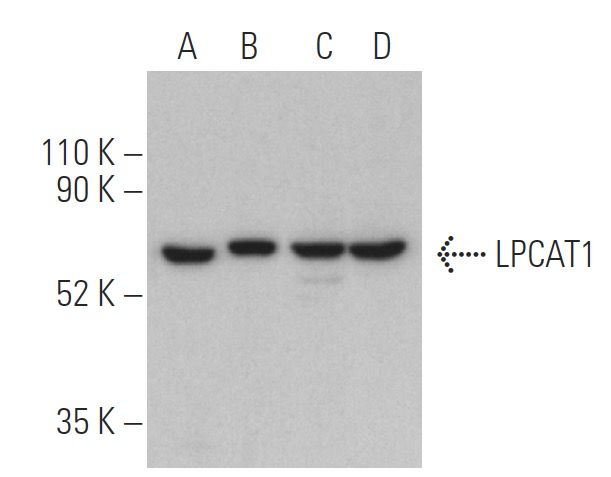 LPCAT1 Antibody (F-9) | SCBT - Santa Cruz Biotechnology