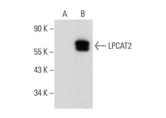 LPCAT2抗体 (H-7) | SCBT - Santa Cruz Biotechnology