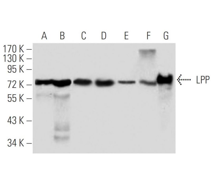 LPP Antibody (8B3A11) | SCBT - Santa Cruz Biotechnology