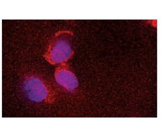 LRAT Antibody (M34-P1F10) - Immunofluorescence - Image 47837