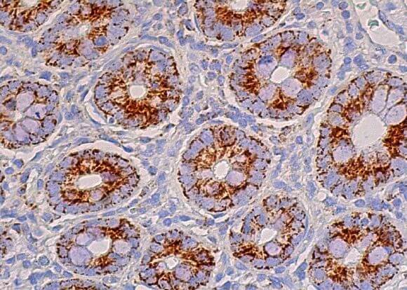 Anti-LRP130 Antibody (F-7) | SCBT - Santa Cruz Biotechnology