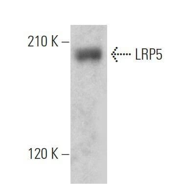 LRP5 Antibody (B-9) | SCBT - Santa Cruz Biotechnology