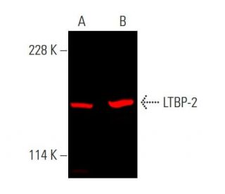 Anti-LTBP-2 Antibody (E-10) | SCBT - Santa Cruz Biotechnology