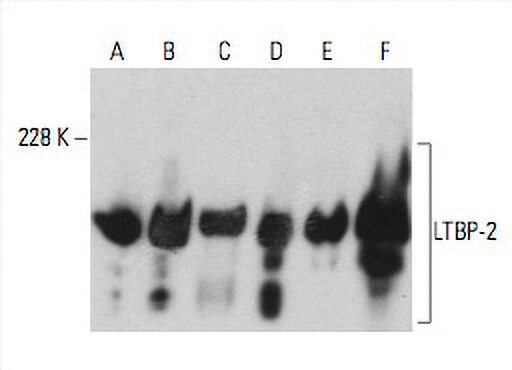 LTBP-2 Antibody (E-10) | SCBT - Santa Cruz Biotechnology
