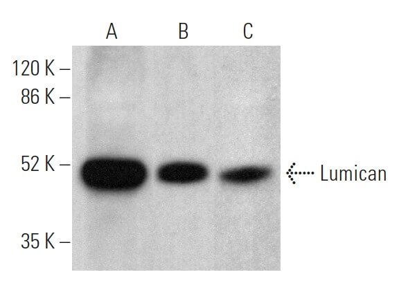 Lumican Antibody (B-9) | SCBT - Santa Cruz Biotechnology