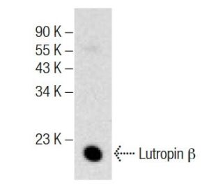 Lutropin β Antibody (B-6) | SCBT - Santa Cruz Biotechnology