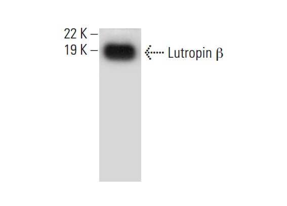 Lutropin β Antibody (C-6) | SCBT - Santa Cruz Biotechnology