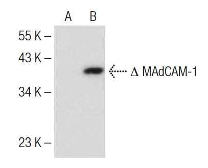 Anti-MAdCAM-1 Antibody (F-6) | SCBT - Santa Cruz Biotechnology