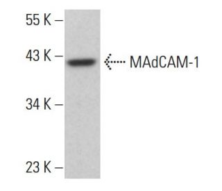 MAdCAM-1 Antibody (F-6) - Western Blotting - Image 375377