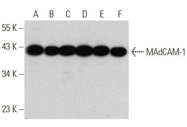Anti-MAdCAM-1 Antibody (H-3) | SCBT - Santa Cruz Biotechnology