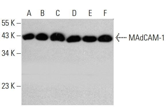 Anti-MAdCAM-1 Antibody (H-3) | SCBT - Santa Cruz Biotechnology