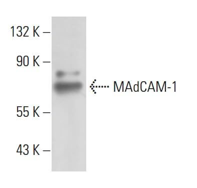 MAdCAM-1 Antibody (MECA-367) | SCBT - Santa Cruz Biotechnology