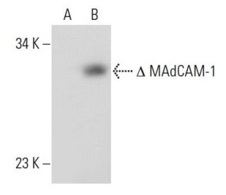 MAdCAM-1 Antibody (MECA-367) | SCBT - Santa Cruz Biotechnology