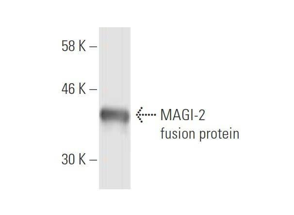MAGI-2 Antibody (6F5) | SCBT - Santa Cruz Biotechnology
