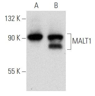 MALT1 Antibody (B-12) | SCBT - Santa Cruz Biotechnology