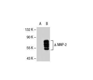 MAP-2 Antibody (A-4) | SCBT - Santa Cruz Biotechnology