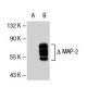 Anti-MAP-2 Antibody (A-4) | SCBT - Santa Cruz Biotechnology