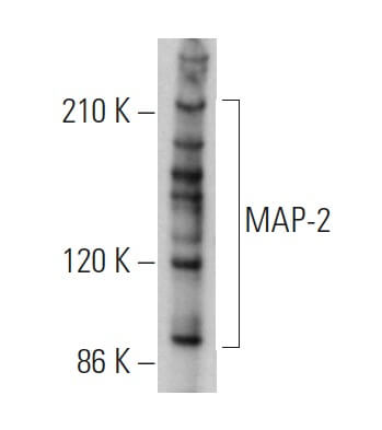 Anti-MAP-2 Antibody (AP20) | SCBT - Santa Cruz Biotechnology