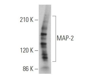MAP-2 Antibody (AP20) - Western Blotting - Image 361001