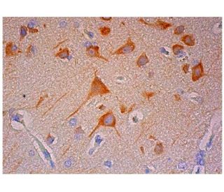 Anti-MAP-2 Antibody (C-2) | SCBT - Santa Cruz Biotechnology