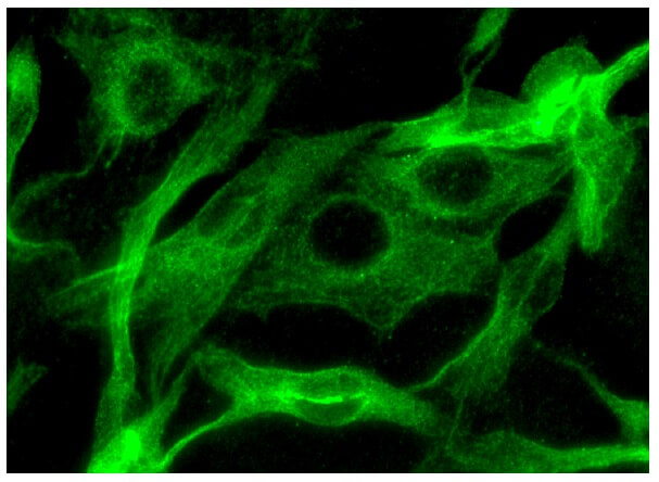 Anti-MAP-4 Antibody (G-10) | SCBT - Santa Cruz Biotechnology
