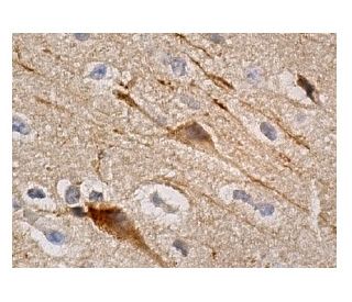 MAP LC3β Antibody (G-2) | SCBT - Santa Cruz Biotechnology