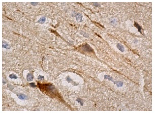 MAP LC3β Antibody (G-2) | SCBT - Santa Cruz Biotechnology