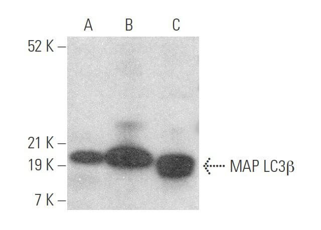 MAP LC3β Antibody (G-2) | SCBT - Santa Cruz Biotechnology