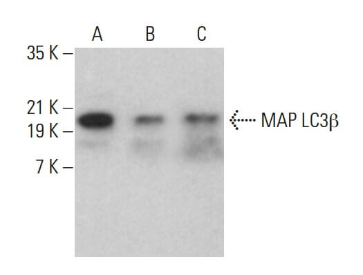 MAP LC3β Antibody (G-2) | SCBT - Santa Cruz Biotechnology