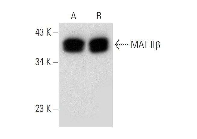 MAT IIβ Antibody (A-3) | SCBT - Santa Cruz Biotechnology
