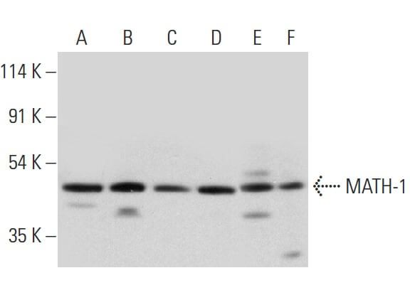 MATH-1抗体 (H-6) | SCBT - Santa Cruz Biotechnology
