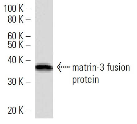 matrin-3 Antibody (2539C3a) | SCBT - Santa Cruz Biotechnology