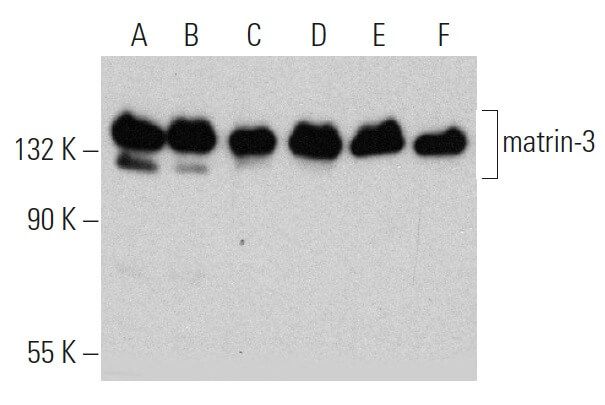 matrin-3 Antibody (C-20) | SCBT - Santa Cruz Biotechnology