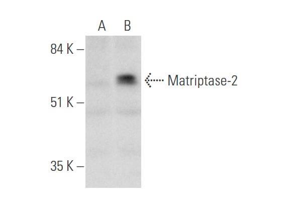 Matriptase-2 Antibody (H-1) | SCBT - Santa Cruz Biotechnology