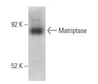 Anti-Matriptase Antibody (D-7) | SCBT - Santa Cruz Biotechnology