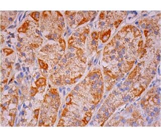 MCP-1 Antibody (1A7B8) - Immunohistochemistry - Image 293332