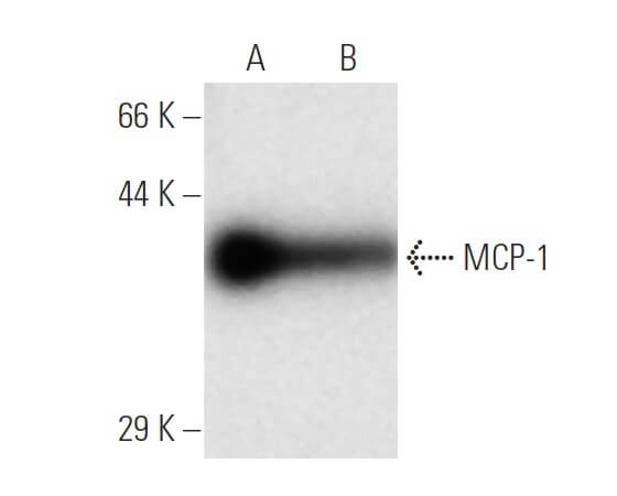 Anti-MCP-1 Antibody (5) | SCBT - Santa Cruz Biotechnology
