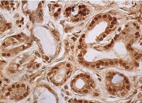 MCR Antibody (H10E4C9F) | SCBT - Santa Cruz Biotechnology