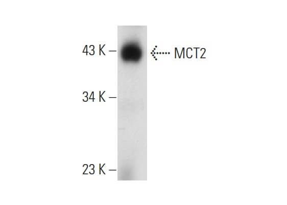 MCT2 Antibody (B-10) | SCBT - Santa Cruz Biotechnology