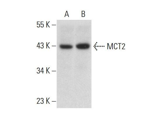 MCT2抗体 (D-5) | SCBT - Santa Cruz Biotechnology