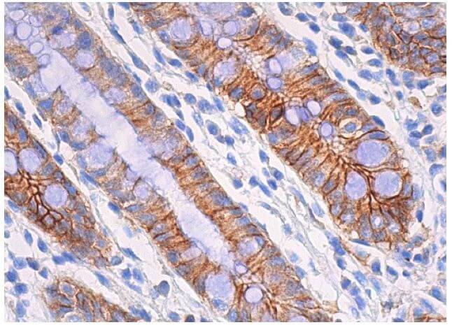 MCT4 Antibody (F-10) | SCBT - Santa Cruz Biotechnology